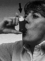 FLIXOTIDE INHALADOR - PLM