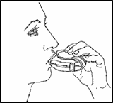 SERETIDE DISKUS - PLM