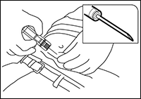 ZOLADEX LA 10.8 MG - PLM