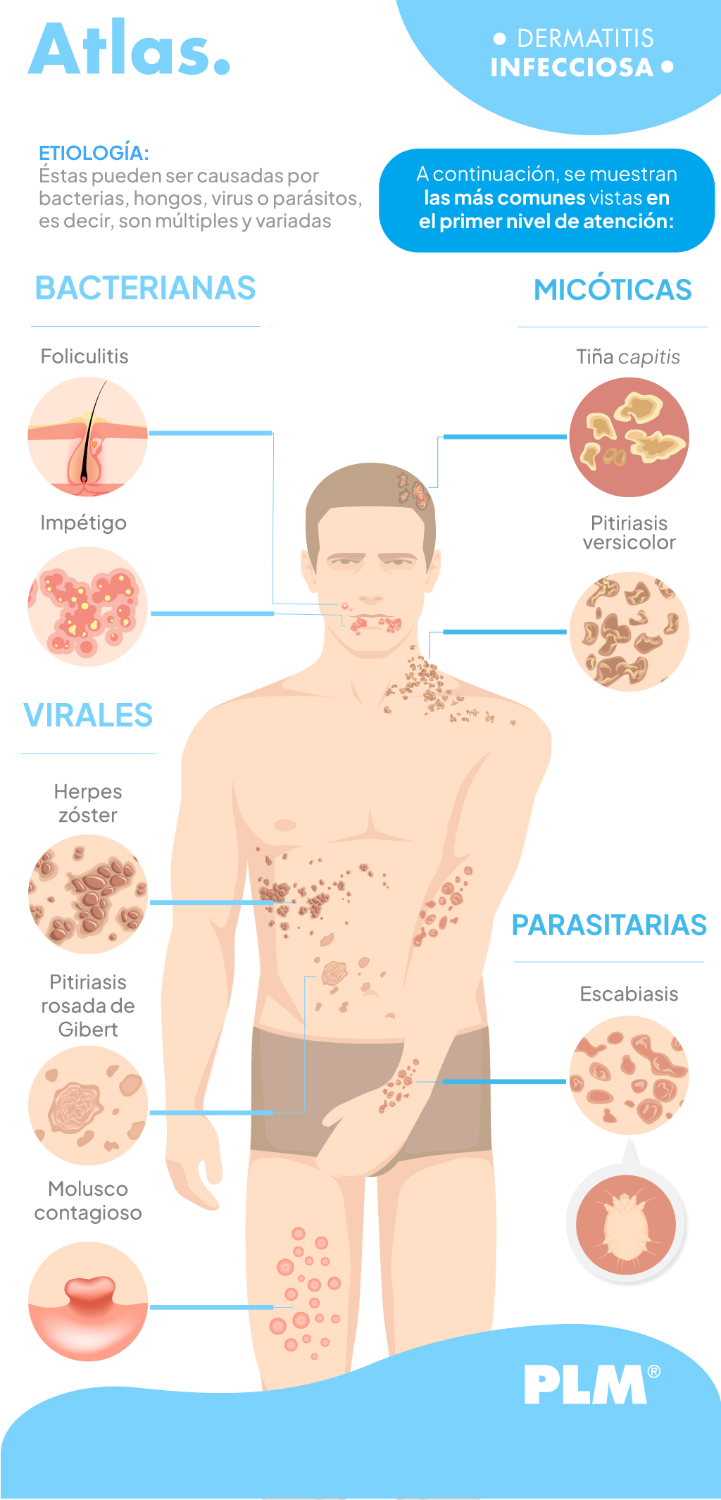 PLM Dermatología | Dermatitis infecciosa