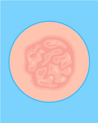 PLM Dermatología | Atlas