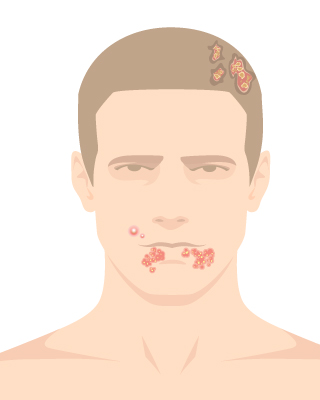 PLM Dermatología | Atlas